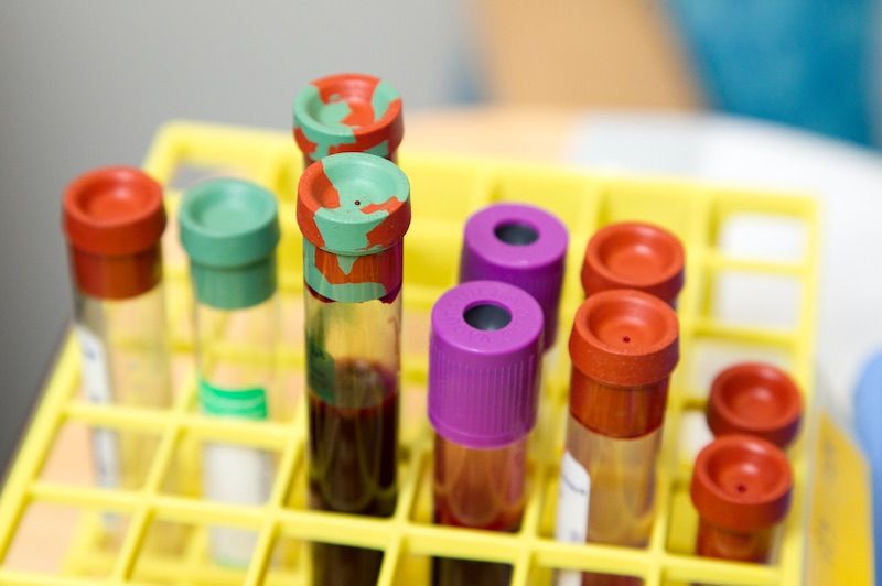Biopsia Corial | Instituto Dra. Gómez Roig